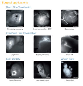 Fluobeam® – Myovatec Surgical Systems