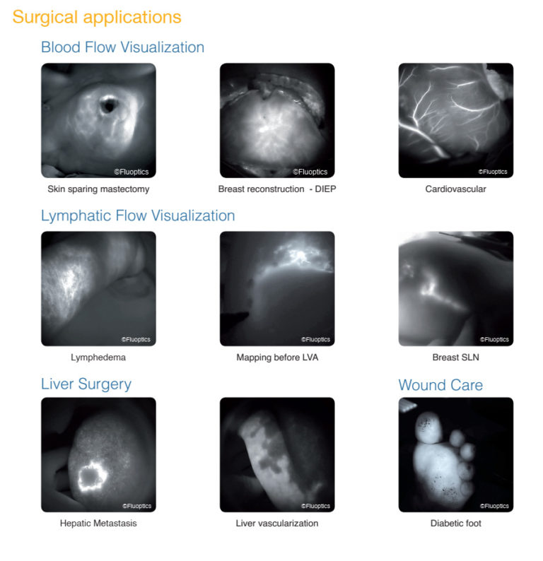 Fluobeam® – Myovatec Surgical Systems