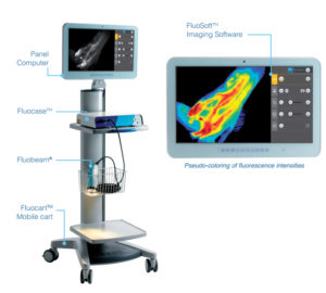 Fluobeam® – Myovatec Surgical Systems