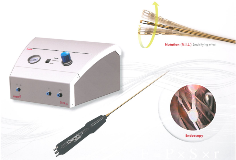 Euromi Liposculpture – Myovatec Surgical Systems